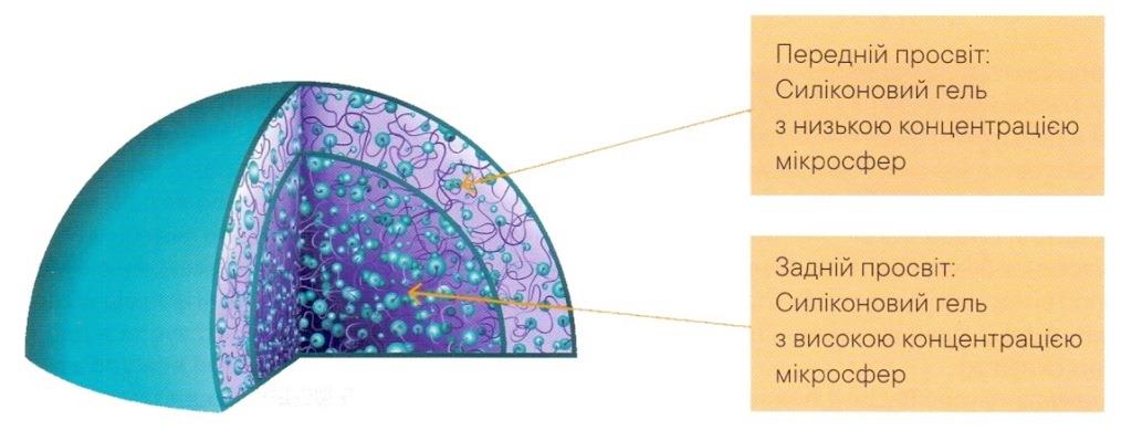 Суперлегкі грудні імплантати B-lite від німецького виробника Polytech ...
